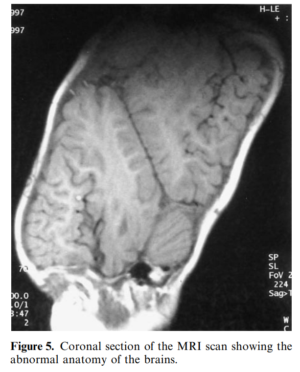 Tard Baby General (includes brain dead kids) | Page 619 | Kiwi Farms