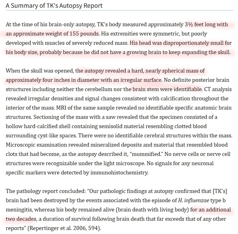 Tard Baby General (includes brain dead kids) | Page 646 | Kiwi Farms